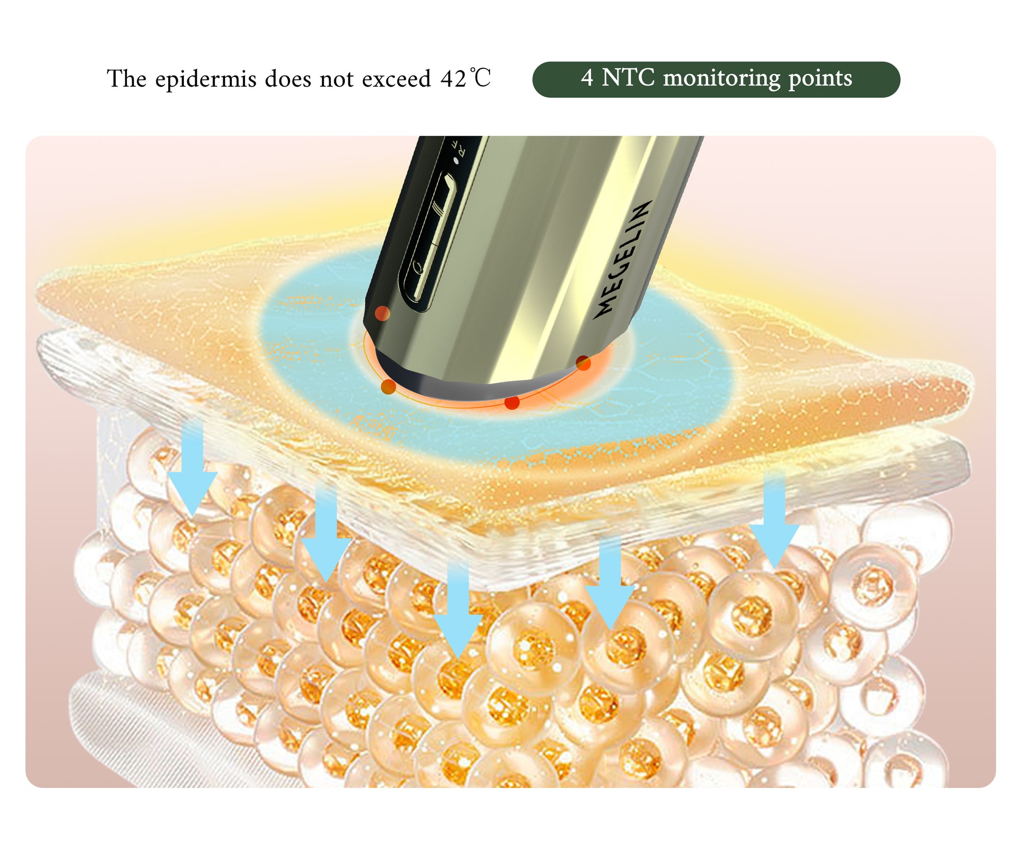 Everything You Need to Know About Radio-Frequency Skin Treatments – Megelin